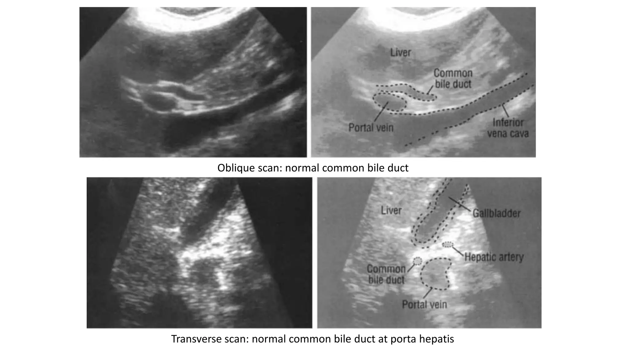 Ultrasound Normal Anatomy of Major Organs | PPTX