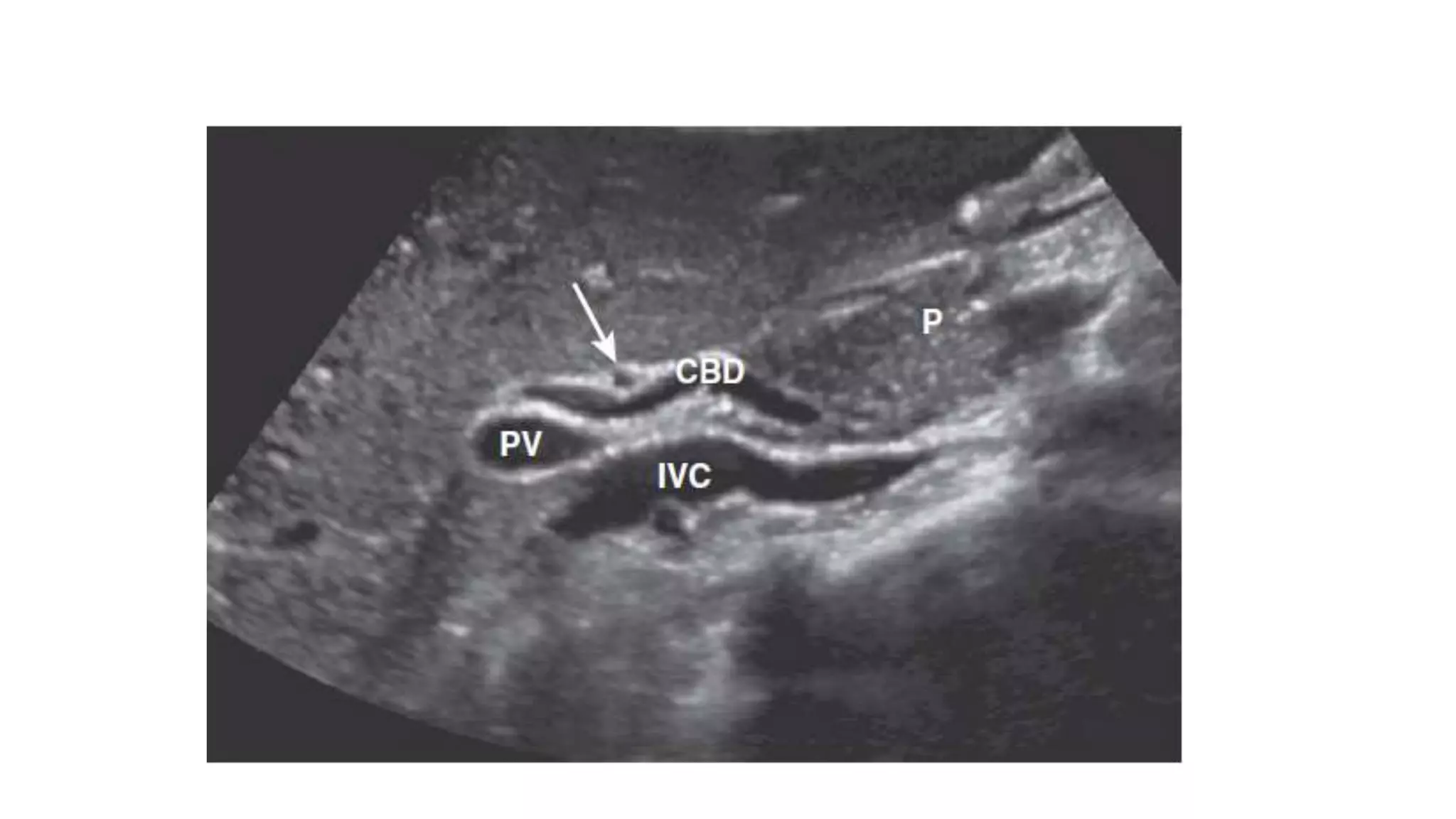 Ultrasound Normal Anatomy of Major Organs | PPTX