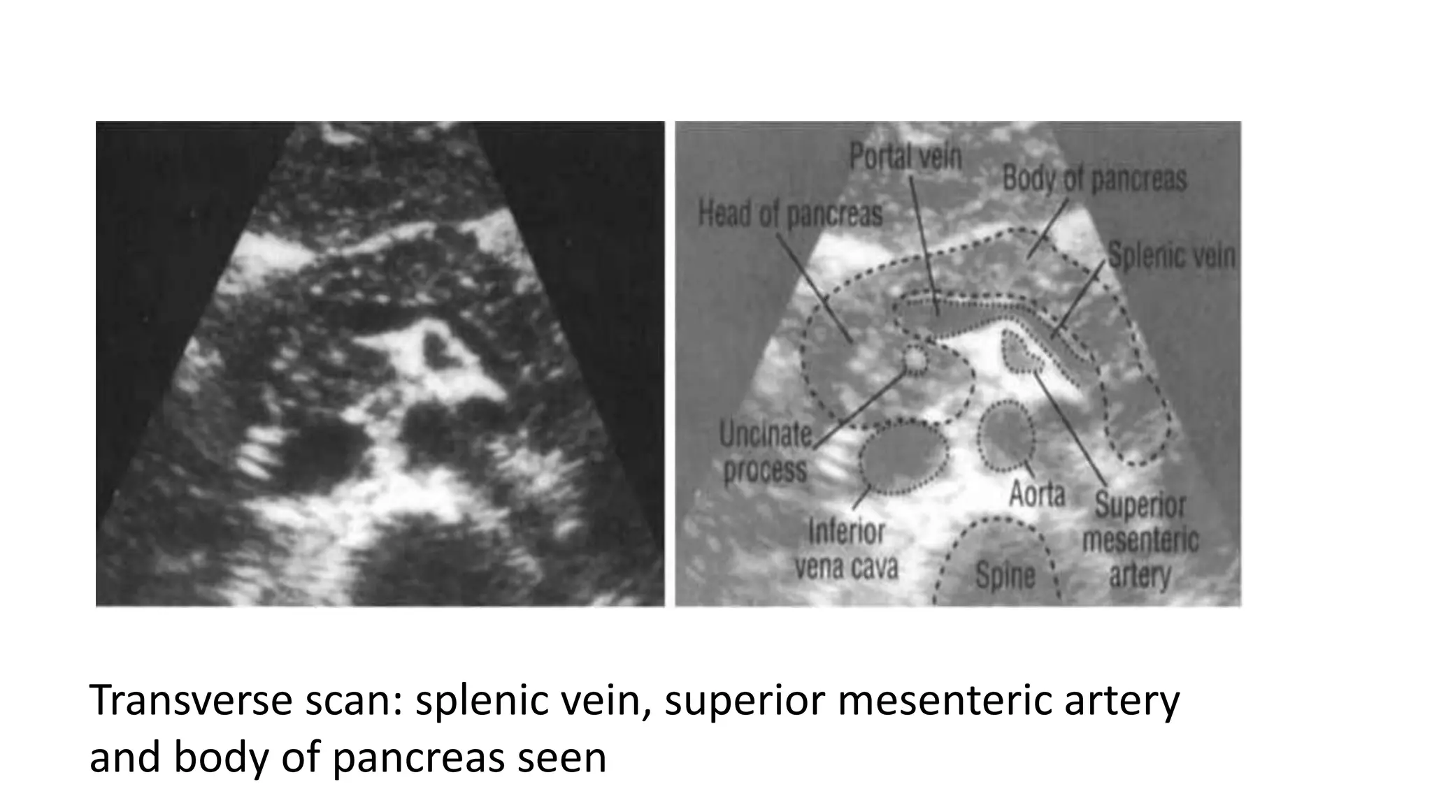 Ultrasound Normal Anatomy of Major Organs | PPTX