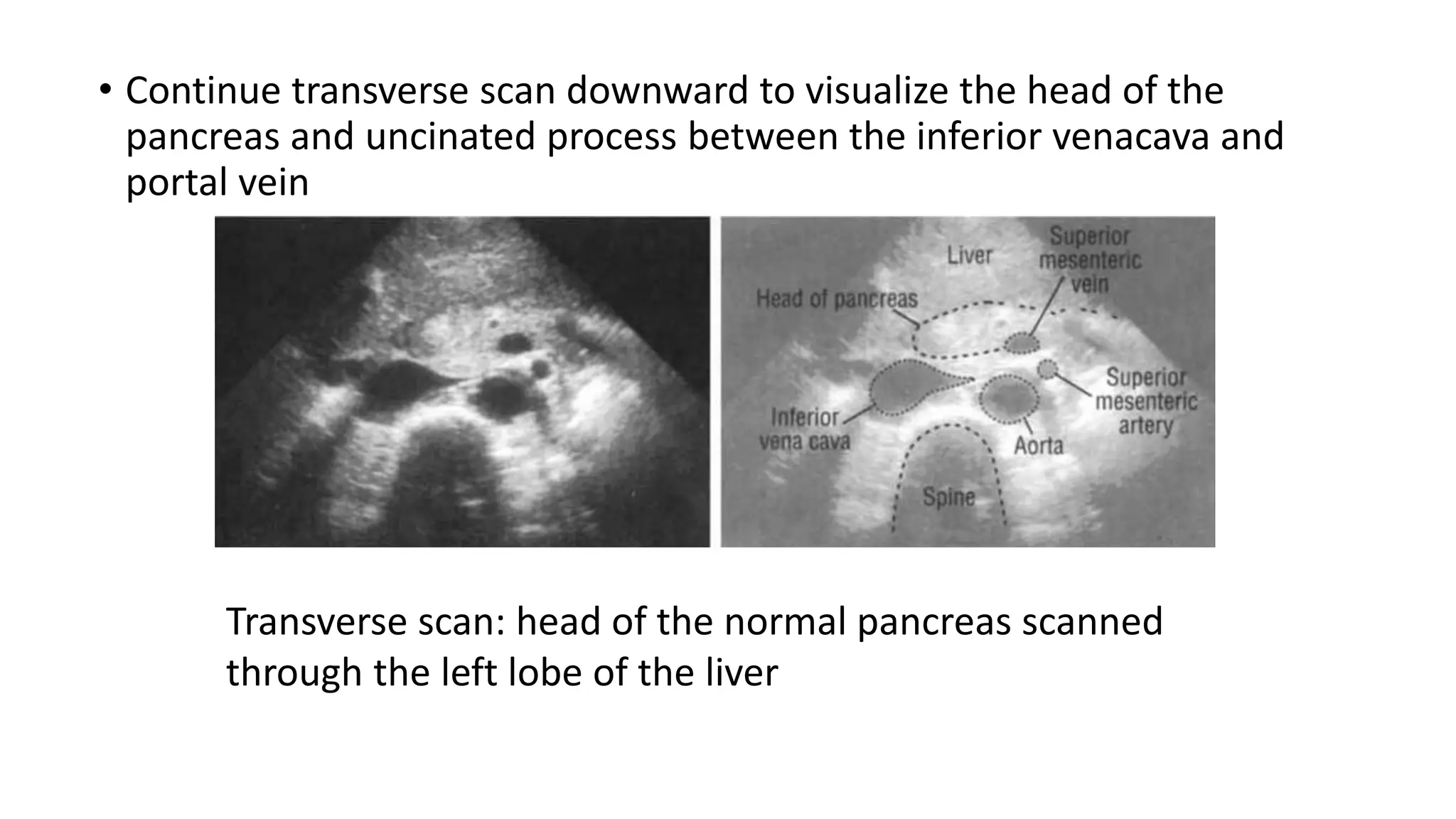 Ultrasound Normal Anatomy of Major Organs | PPTX