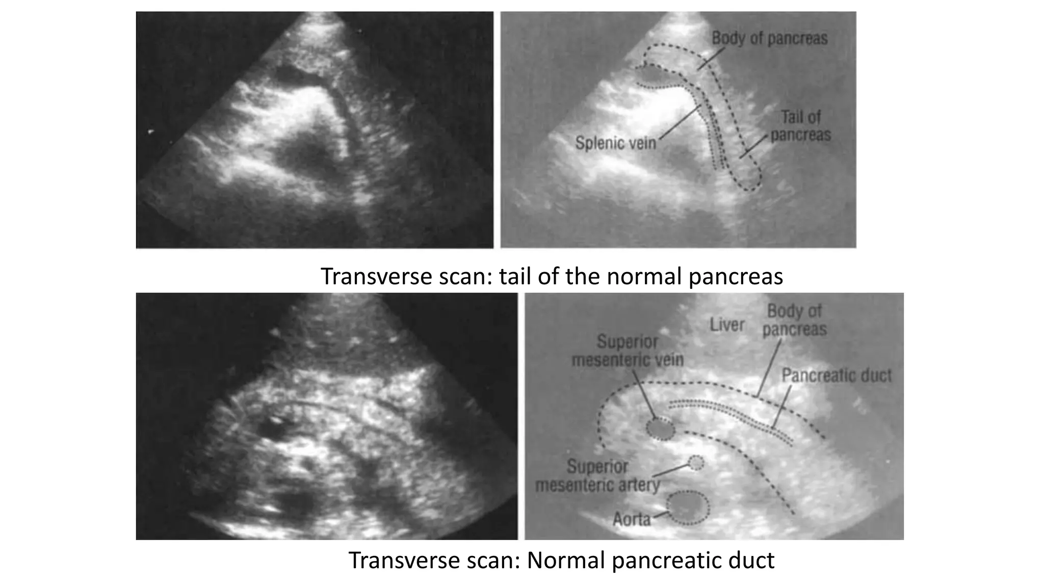 Ultrasound Normal Anatomy of Major Organs | PPTX | Pregnancy ...