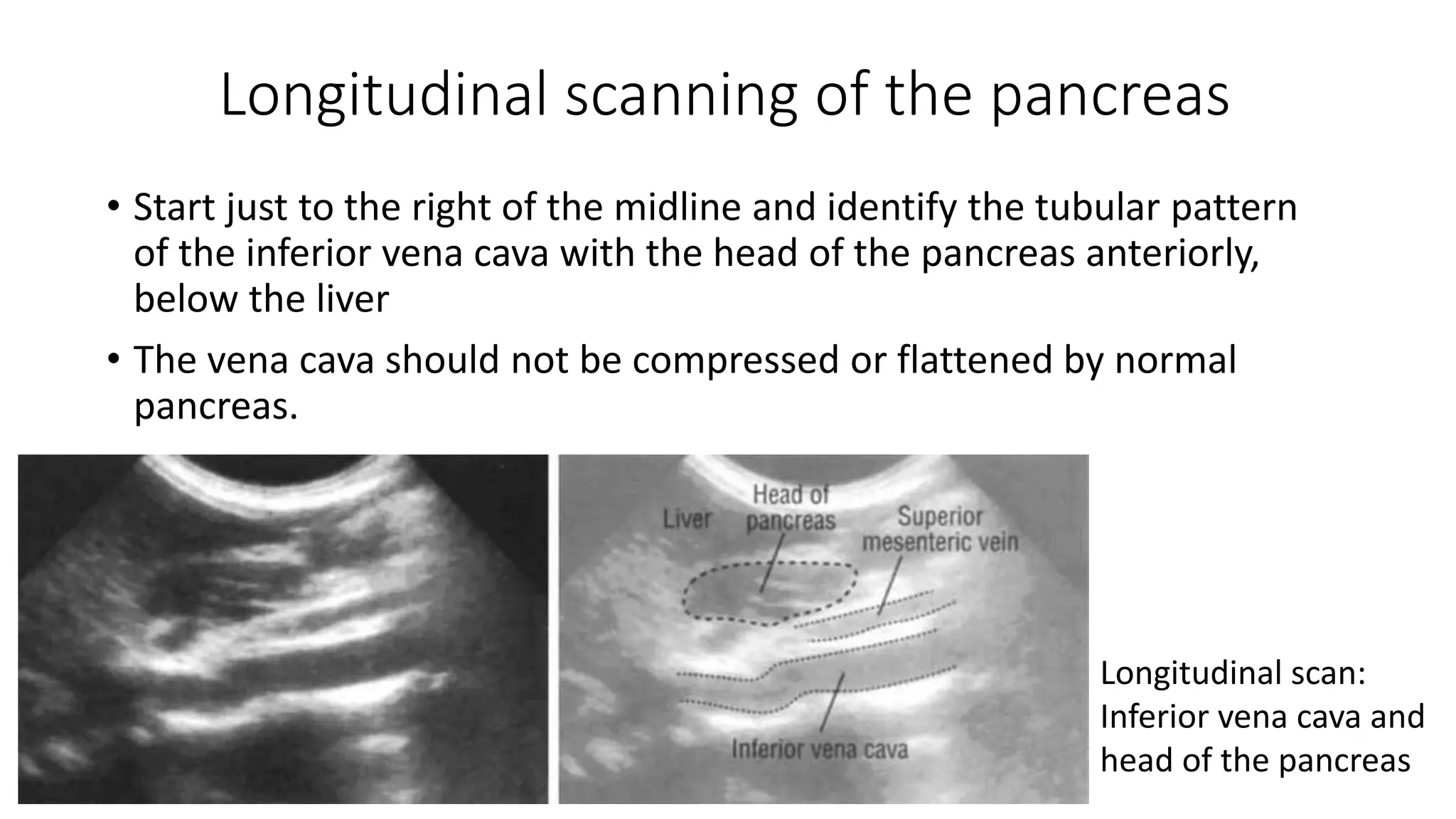 Ultrasound Normal Anatomy of Major Organs | PPTX | Pregnancy ...