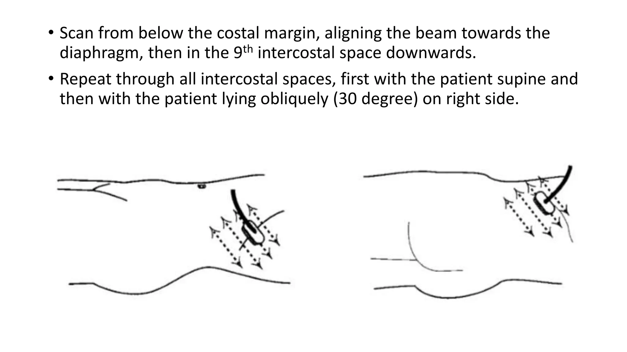 Ultrasound Normal Anatomy of Major Organs | PPTX