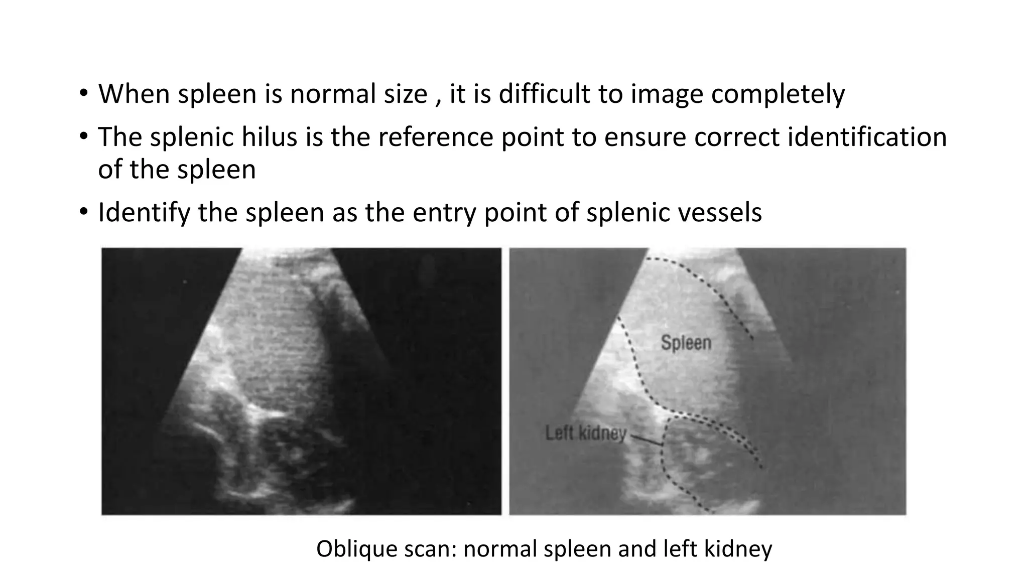 Ultrasound Normal Anatomy of Major Organs | PPTX