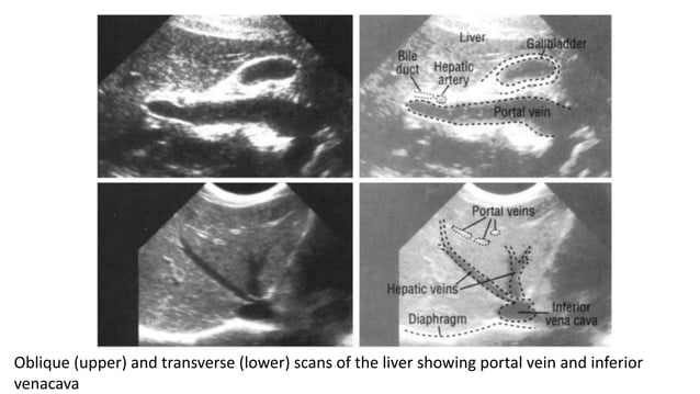 Ultrasound Normal Anatomy of Major Organs | PPTX | Pregnancy ...