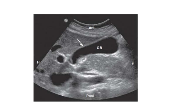 Ultrasound Normal Anatomy of Major Organs | PPTX | Pregnancy ...
