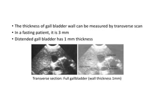 Ultrasound Normal Anatomy of Major Organs | PPTX