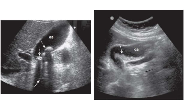 Ultrasound Normal Anatomy of Major Organs | PPTX | Pregnancy ...