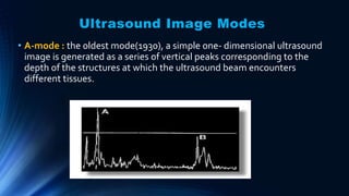Usg and anaesthesia | PPTX
