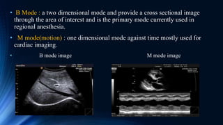 Usg and anaesthesia | PPTX