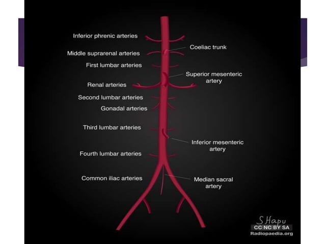 USG of Aorta and Coeliac axis | PPTX | Heart and Cardiovascular ...