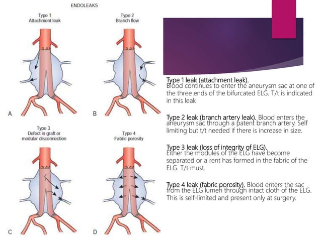 USG of Aorta and Coeliac axis | PPTX | Heart and Cardiovascular ...