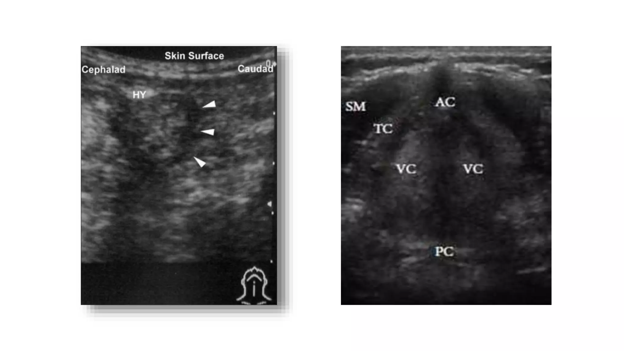 Usg applications in anaesthesia dr gs | PPTX | Physics | Science