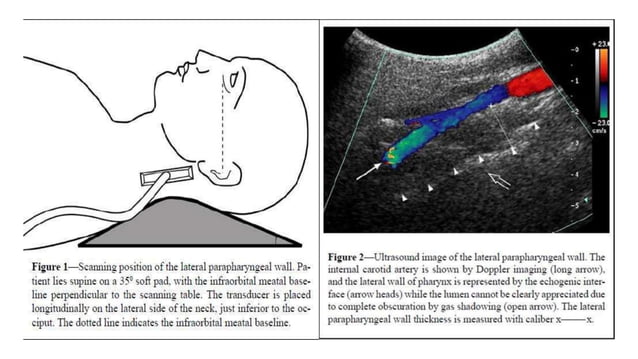 Usg applications in anaesthesia dr gs | PPTX | Physics | Science