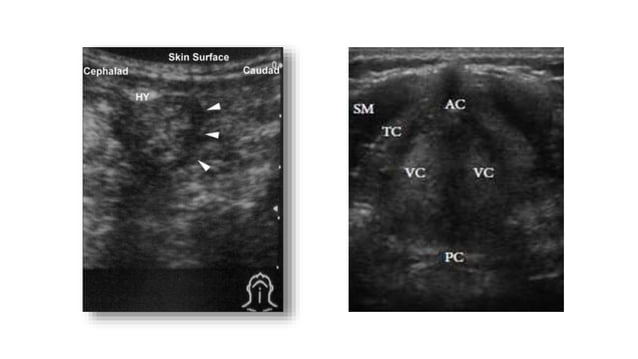 Usg applications in anaesthesia dr gs | PPTX | Physics | Science