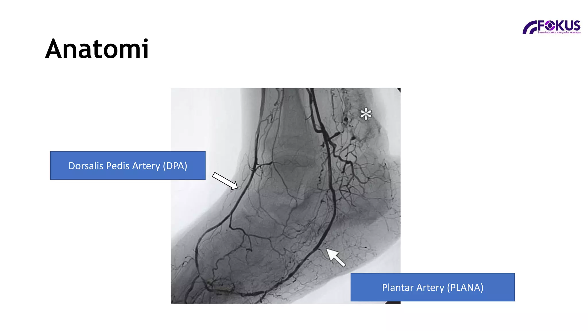 USG Arteri Extremitas Bawah/Inferior | PPTX