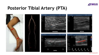 USG Arteri Extremitas Bawah/Inferior | PPTX