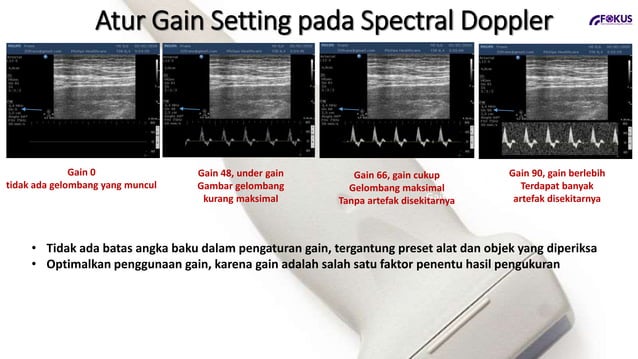 USG Arteri Extremitas Bawah/Inferior | PPTX