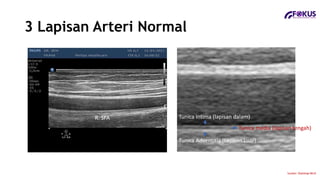 USG Arteri Extremitas Bawah/Inferior | PPTX