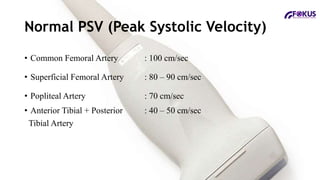 USG Arteri Extremitas Bawah/Inferior | PPTX