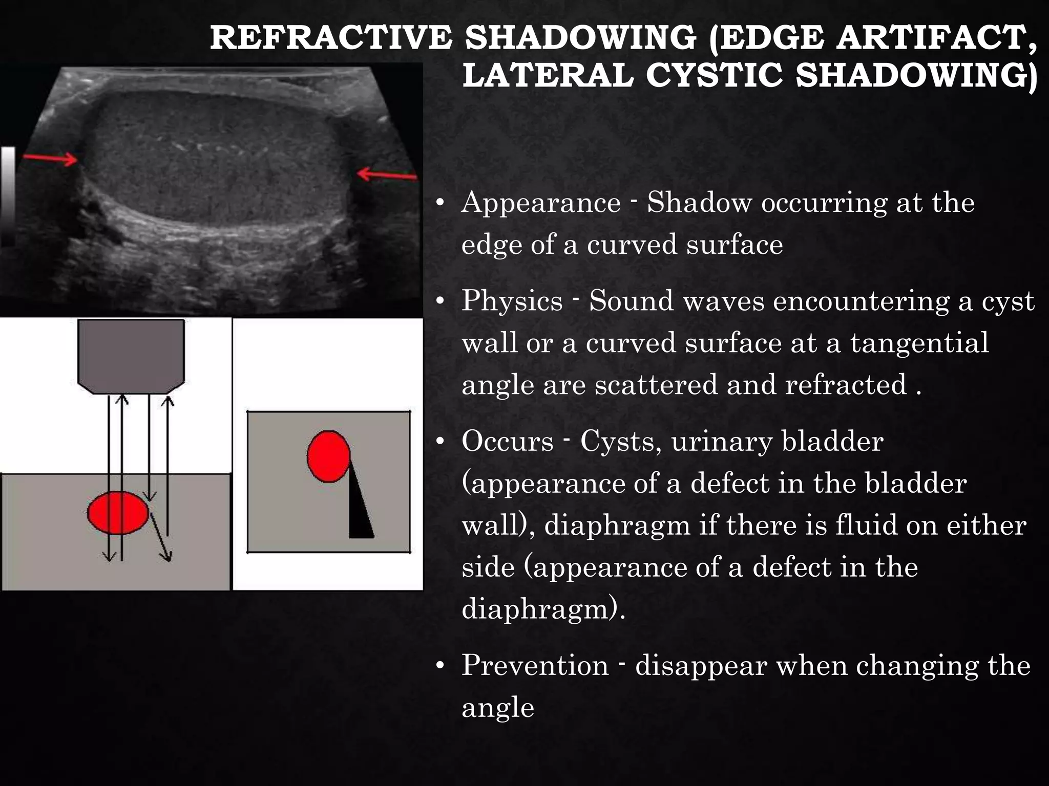 Usg artifacts | PPTX