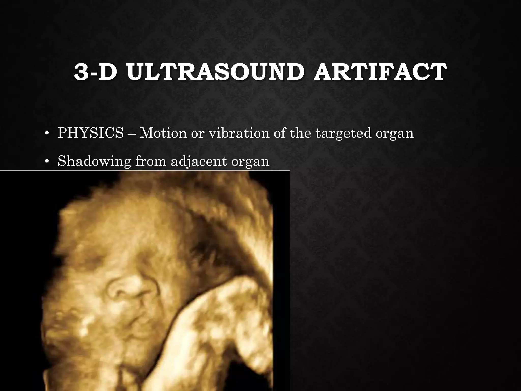 Usg artifacts | PPTX