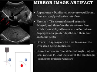 Usg artifacts | PPTX