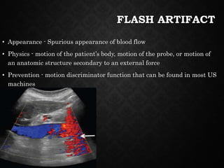 Usg artifacts | PPTX