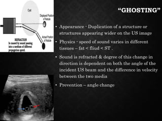 Ghosting In Color Doppler