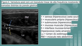 Us gastrico pocus | PDF