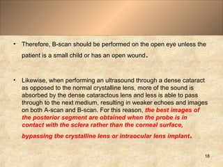 USG B Scan | PPT