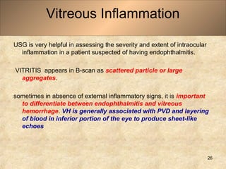 USG B Scan | PPT