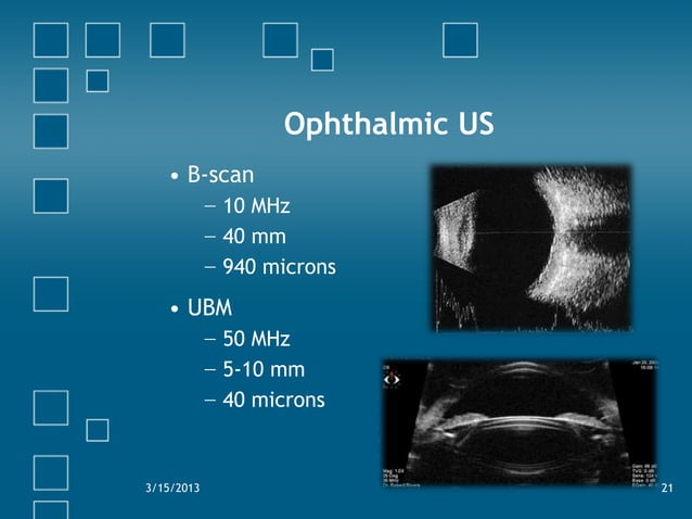 USG B SCAN OPHTHALMOLOGY | PDF