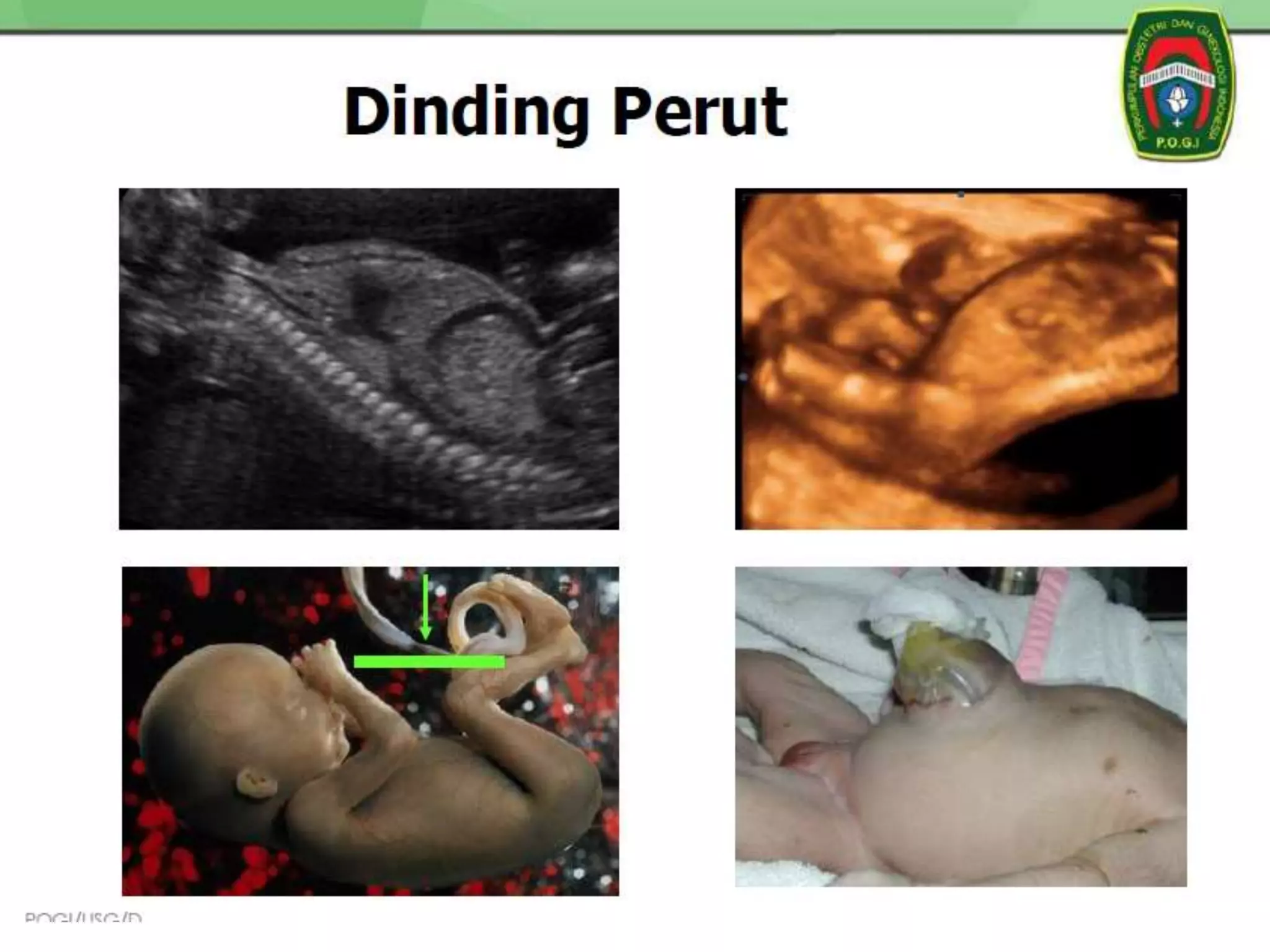 USG dan doppler dalam Obstetri-ginekologi 28-8-2021.pptx