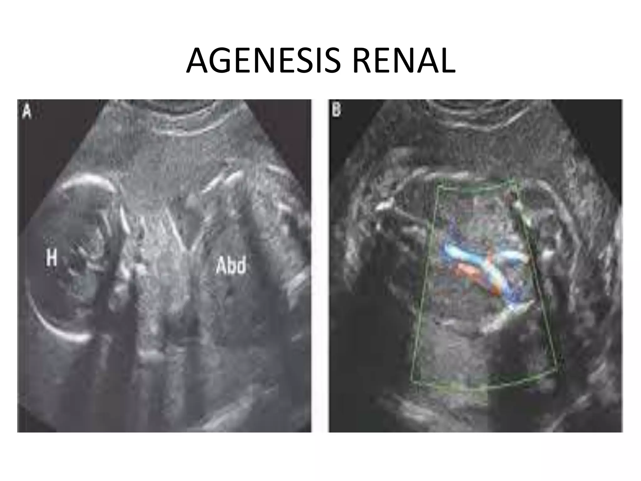 USG dan doppler dalam Obstetri-ginekologi 28-8-2021.pptx