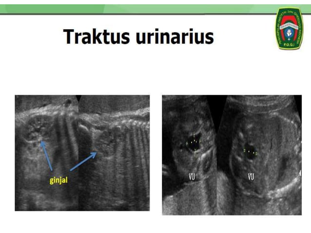 USG dan doppler dalam Obstetri-ginekologi 28-8-2021.pptx