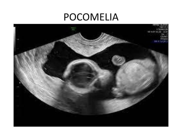 USG dan doppler dalam Obstetri-ginekologi 28-8-2021.pptx