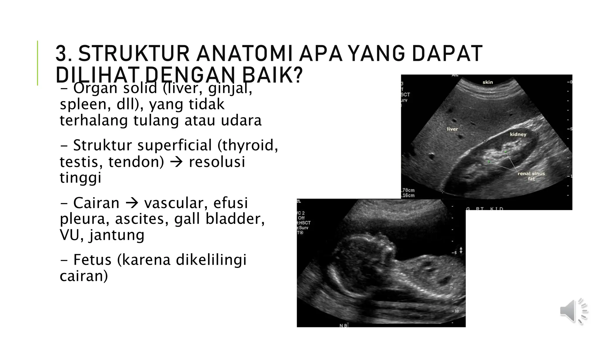 Pengenalan Alat Ultrasonografi Dasar.pptx