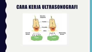 usg dasar ultrasonografi dasaar dasar.pptx