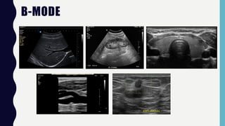 usg dasar ultrasonografi dasaar dasar.pptx
