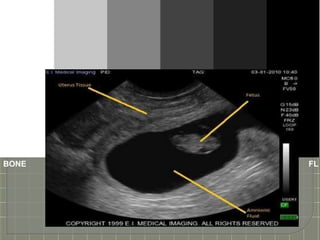 usg diplay mode.pptx