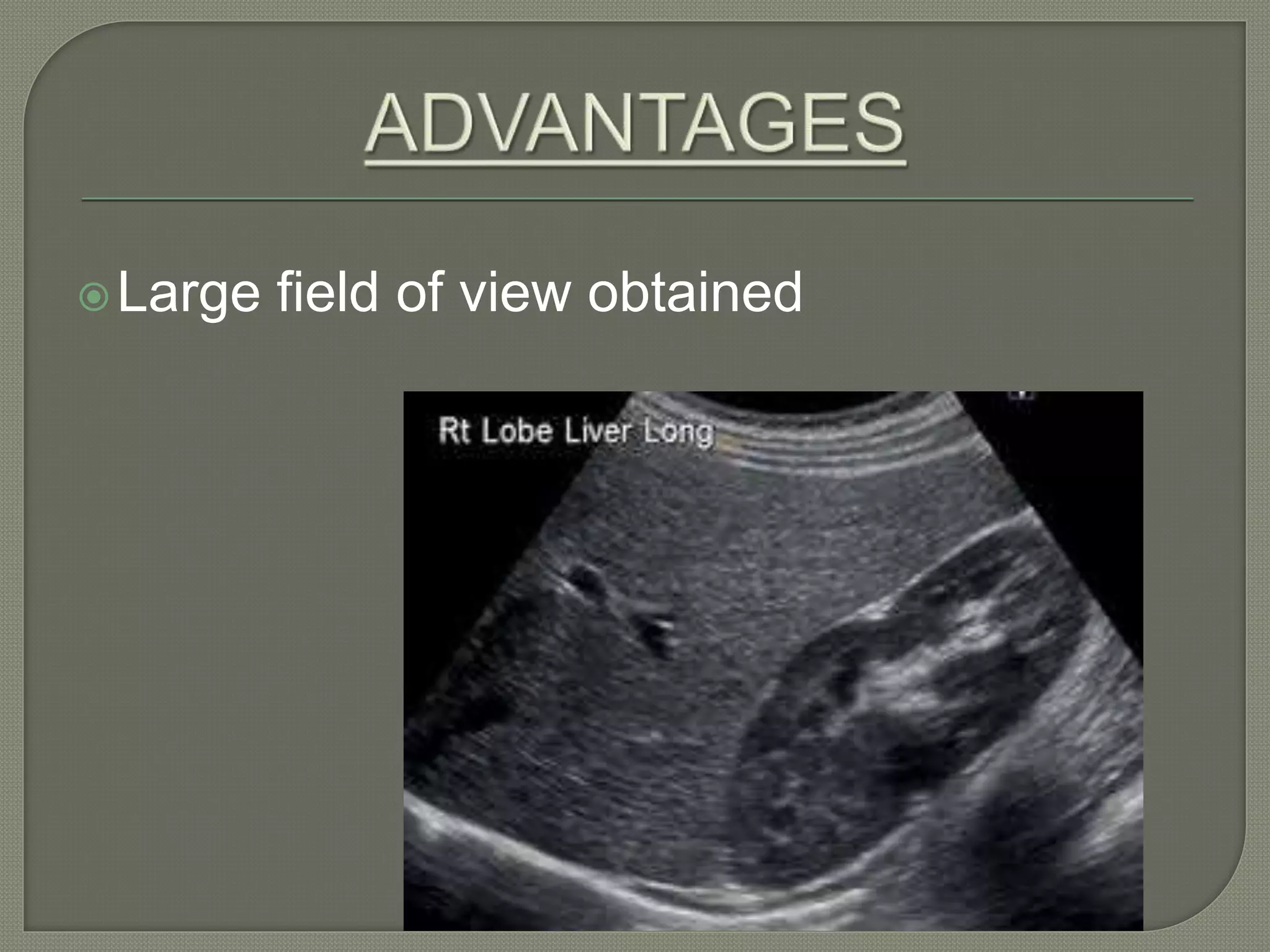 Usg diplay modes | PPTX