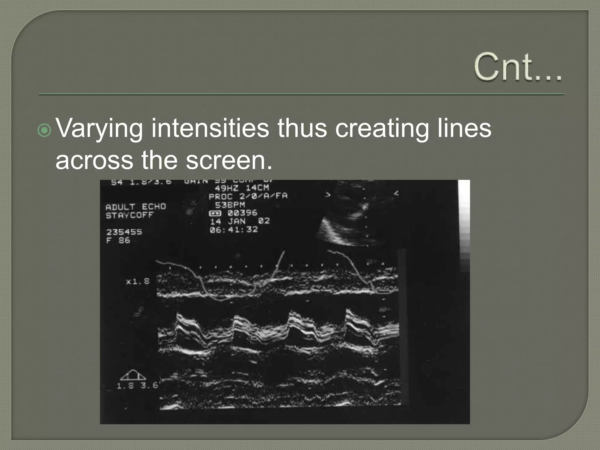 Usg diplay modes | PPTX