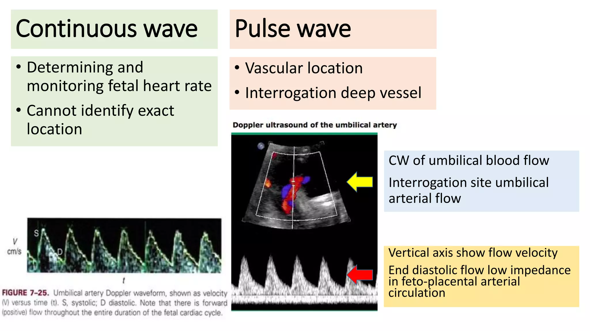 Doppler Ultrasound of Umbilical Artery | PPTX