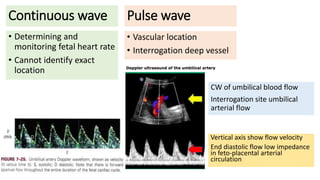 Doppler Ultrasound of Umbilical Artery | PPTX