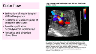 Doppler Ultrasound of Umbilical Artery | PPTX