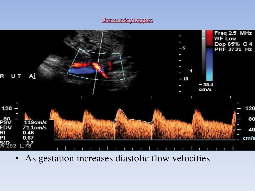 USG AND DOPPLER IN DIAGNOSIS AND MANAGEMENT OF IUGR