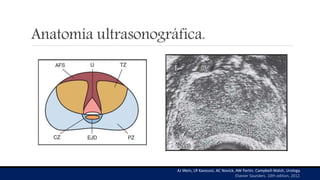 BIOPSIA DE PROSTATA POR USG | PPTX