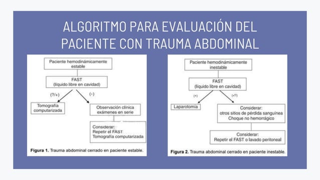 USG FAST en Trauma | PPTX