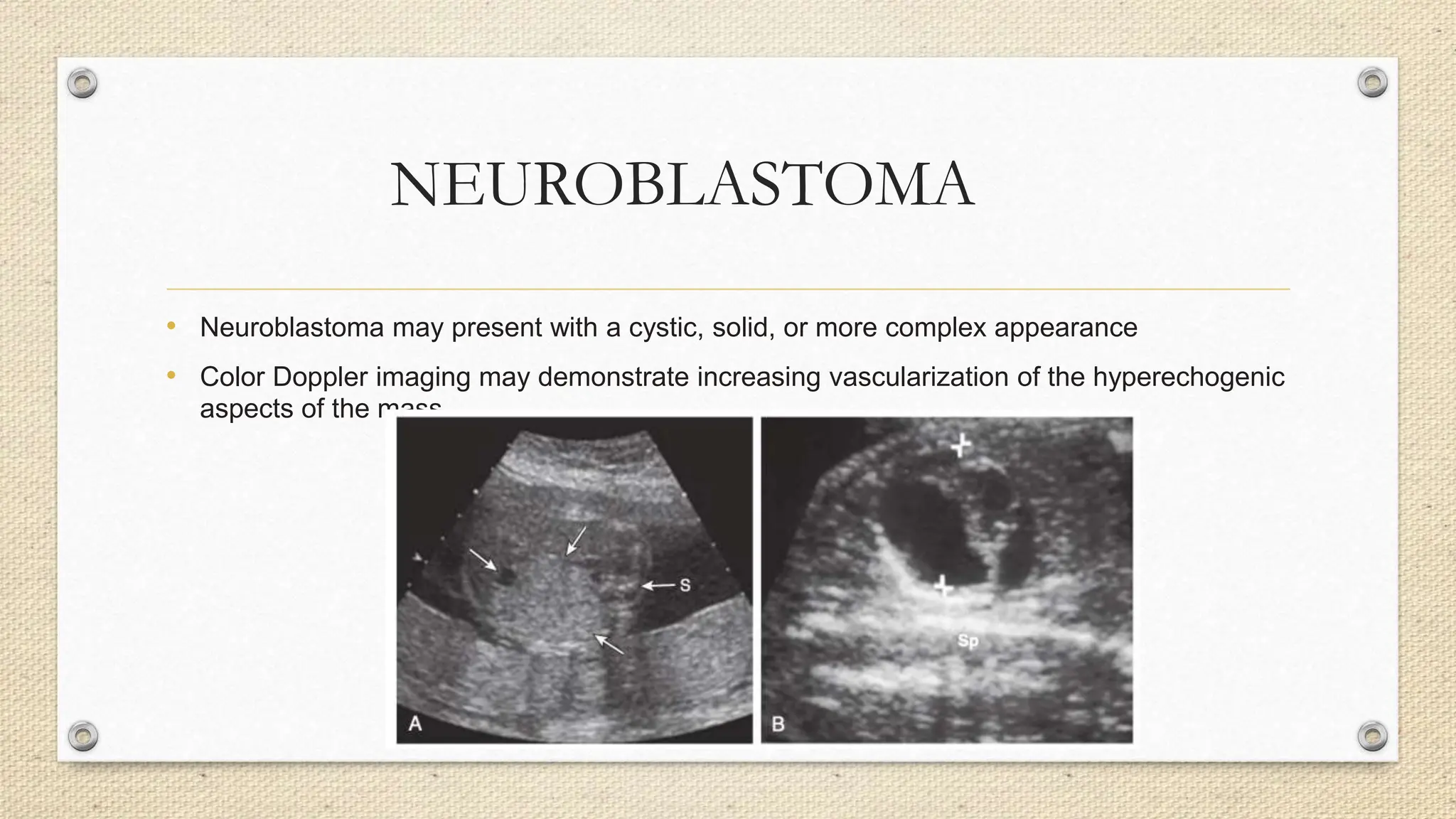 USG Fetal Gut .pptx